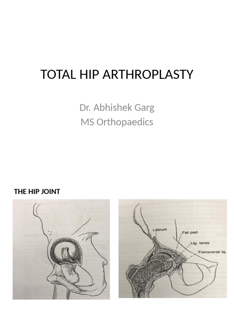 Total Hip Arthroplasty Overview | PDF | Hip | Anatomical Terms Of Location