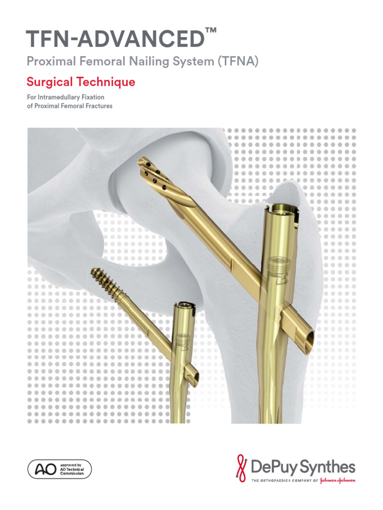 Surgical Technique Guide - TFN-ADVANCED Proximal Femoral Nailing System ...