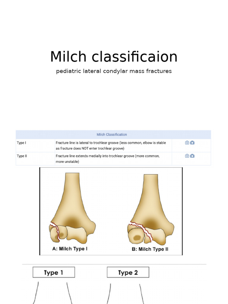 Milch and Elbow Ossification | PDF