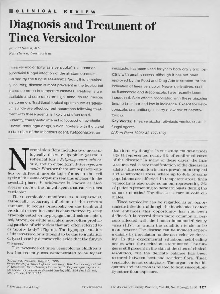 JFP - 1996 08 - v43 - I2 - Diagnosis and Treatment of Tinea Versico ...