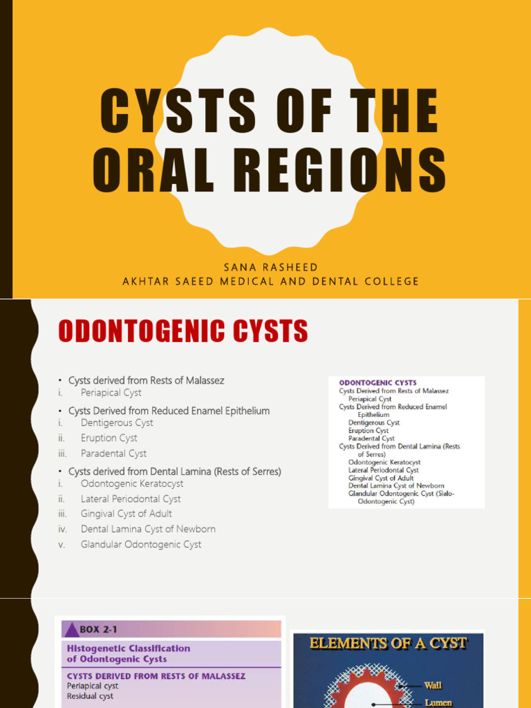cystsoftheoralregions | PDF | Epithelium | Dental Anatomy