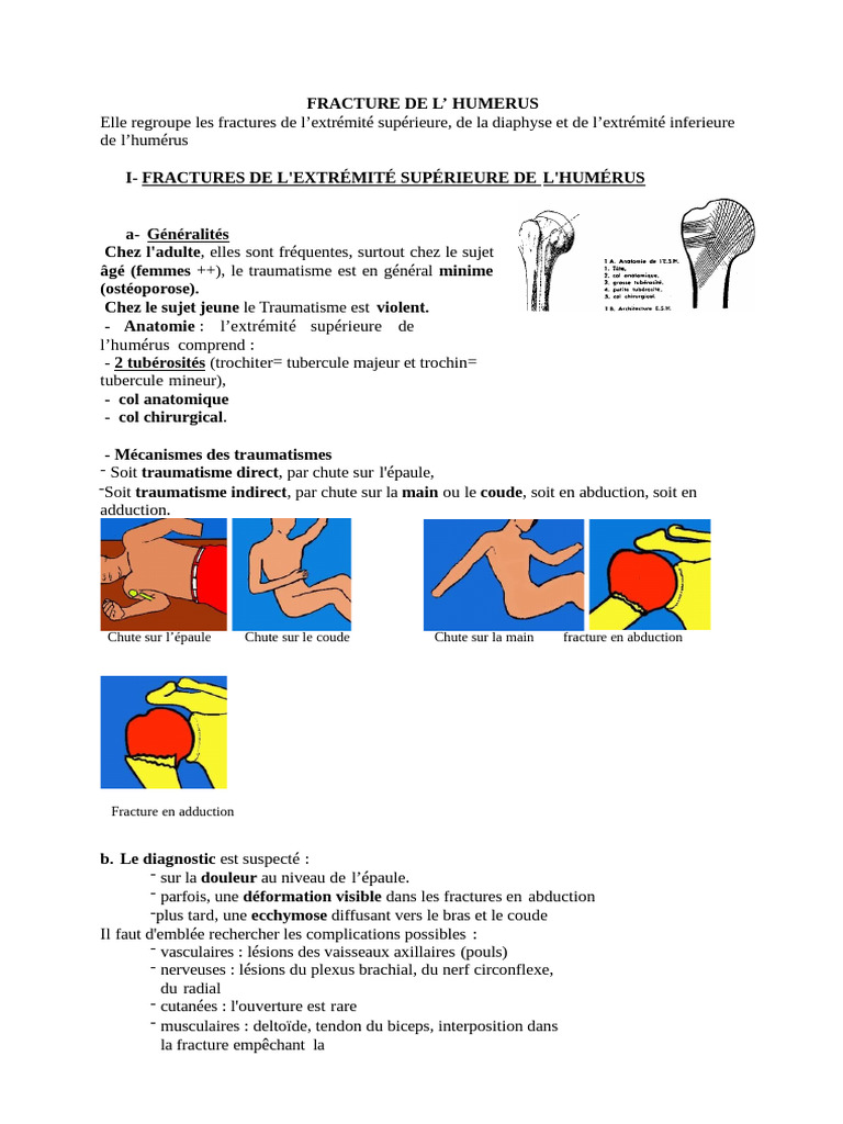Fractures de l'Humérus : Types et Traitements | PDF | Appareil ...