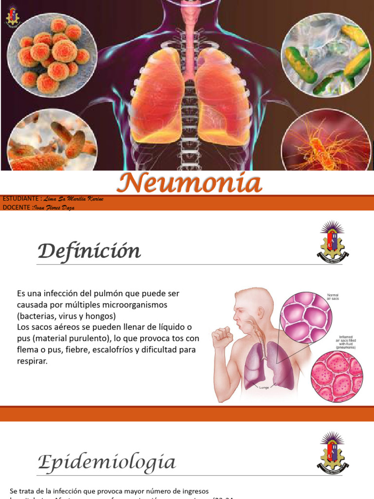 Guía Completa sobre Neumonía | PDF | Neumonía | Inmunología