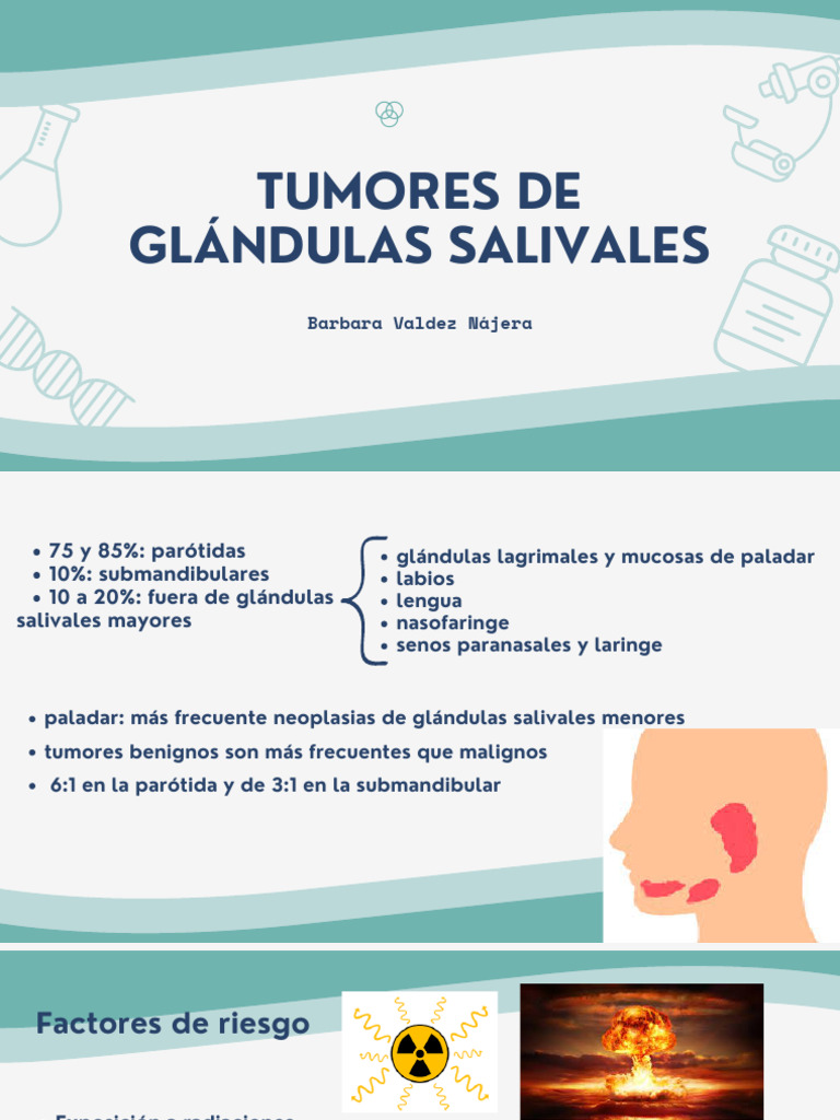 Tumores de Glándulas Salivales | PDF | Cáncer | Neoplasias