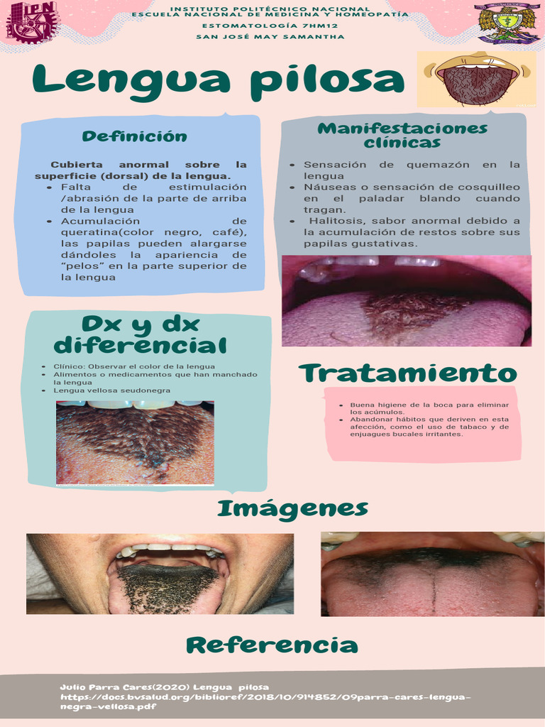 _Lengua Pilosa. San José May Samantha | PDF