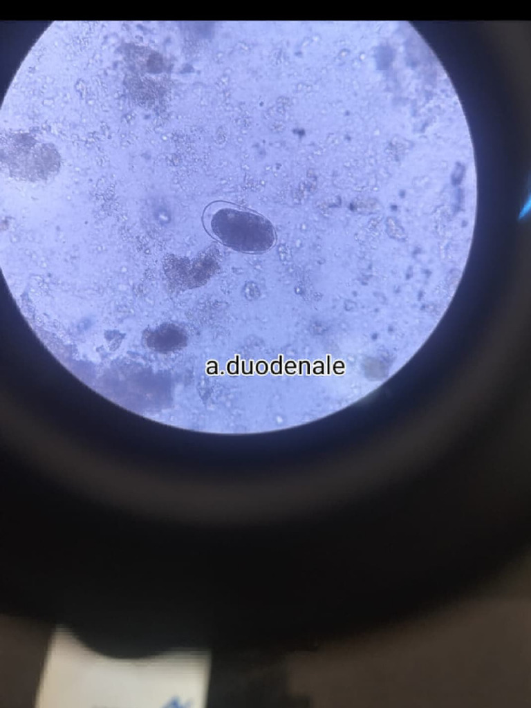 Parasitology Ova-cyst Slides,Viva Q-A | PDF | Parasitism | Parasitology