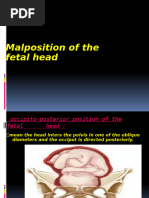 Fetal Head Malposition Management Guide | PDF | Pelvis | Childbirth