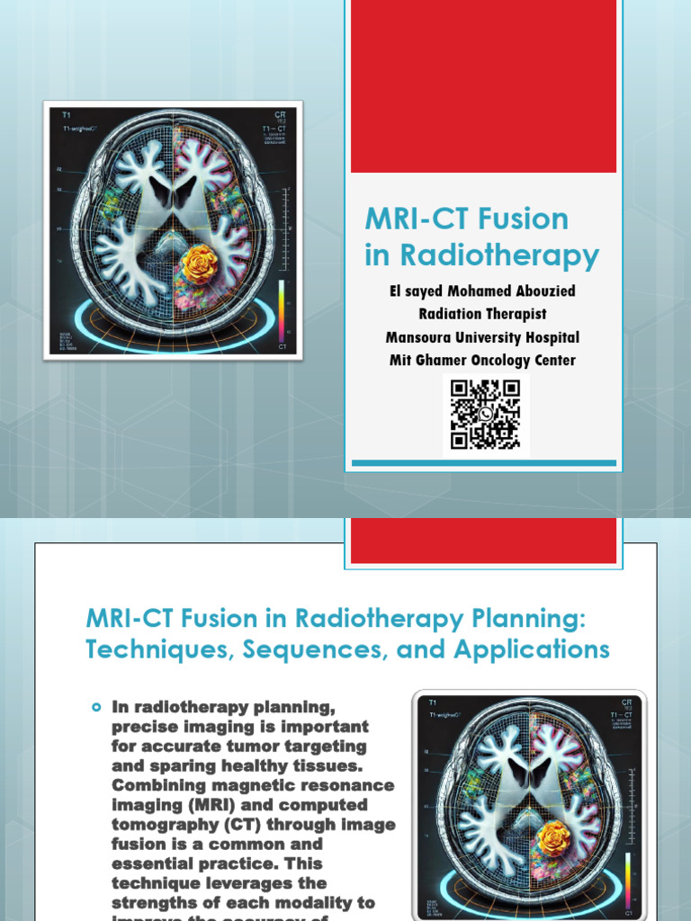 MRI-CT Fusion in Radiotherapy Planning | PDF | Radiation Therapy ...