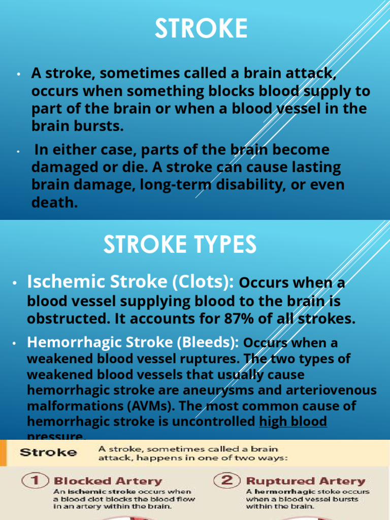 Brain Pathology in CT ( Stroke and Hemorrhage ) | PDF | Stroke ...