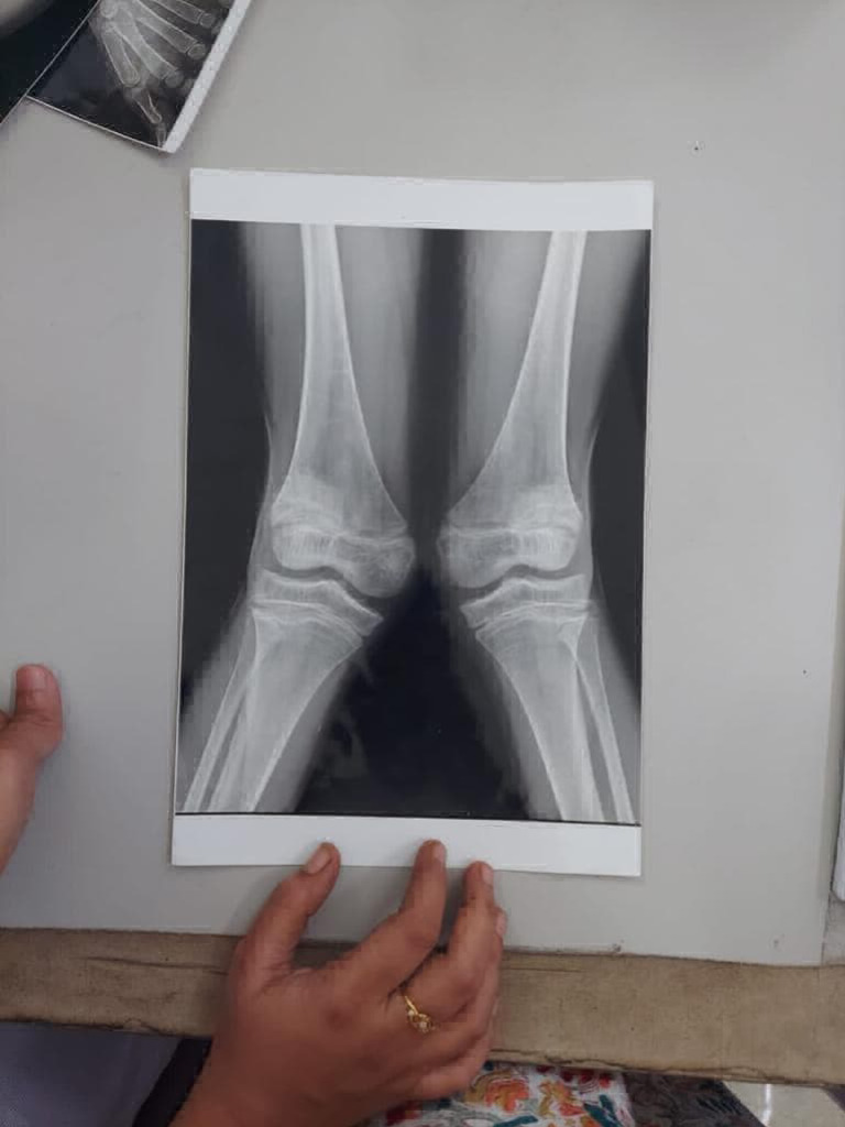 Ortho X Rays-1 | PDF