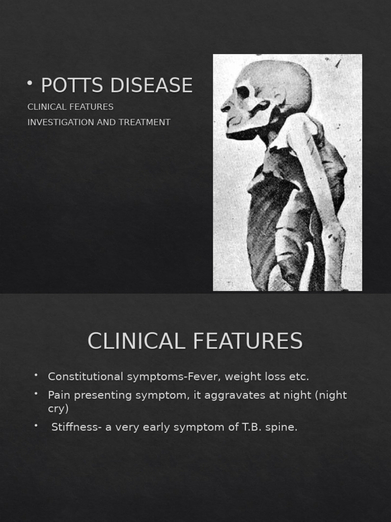 Potts Disease | PDF | Vertebra | Vertebral Column
