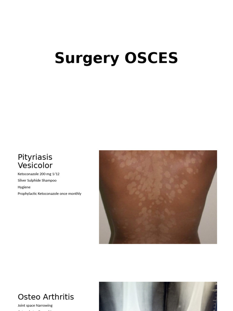 Surgery OSCES | PDF