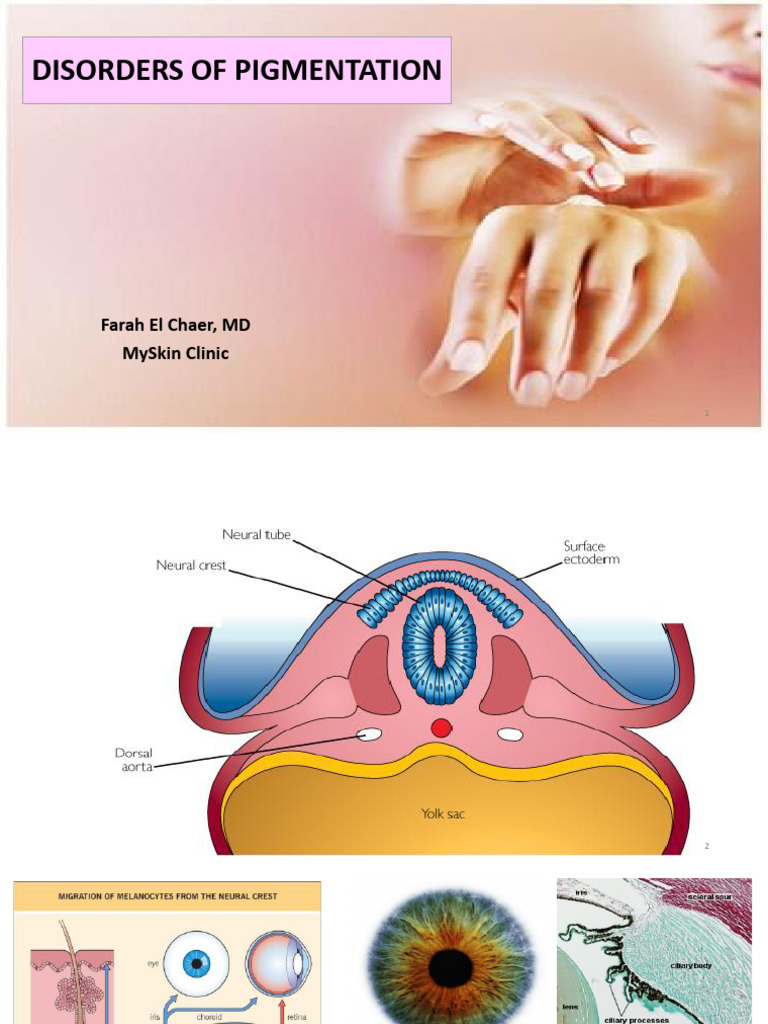 Disorders of Pigmentation Explained | PDF | Human Skin Color | Ultraviolet
