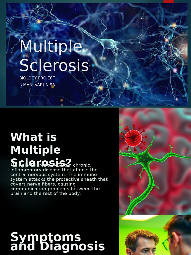 What is Multiple Sclerosis | PDF