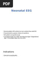 ACNS Standardized Critical Care EEG Examples 2021 | PDF ...