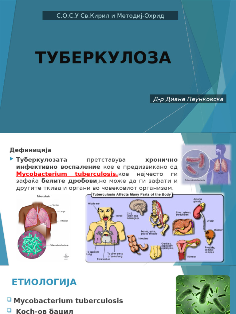 Tuberkuloza Diana Paunkovska | PDF