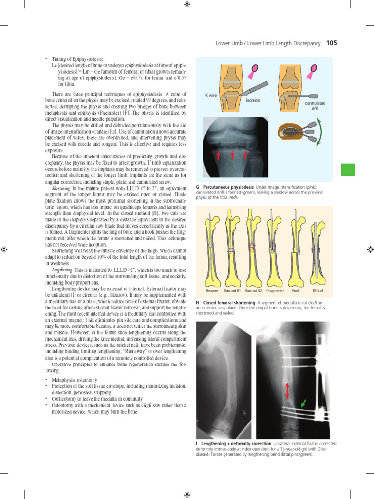05 Lower Limb-15 | PDF | Musculoskeletal System