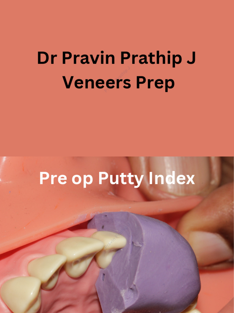 DR Pravin Veneers | PDF