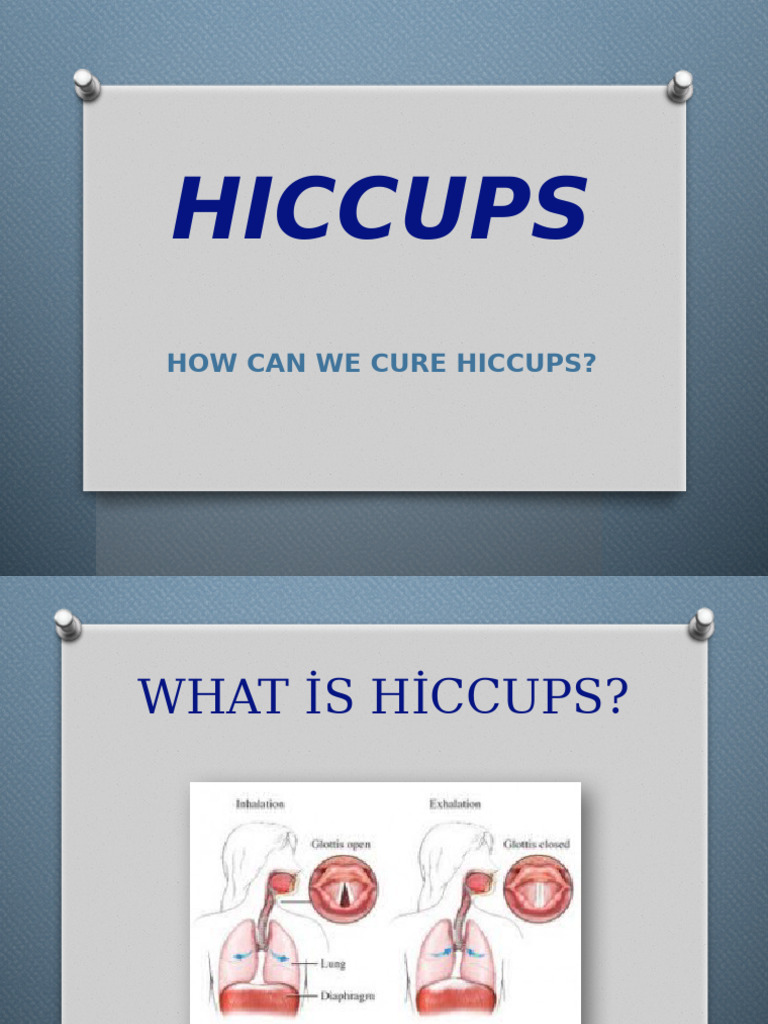 HICCUPS | PDF