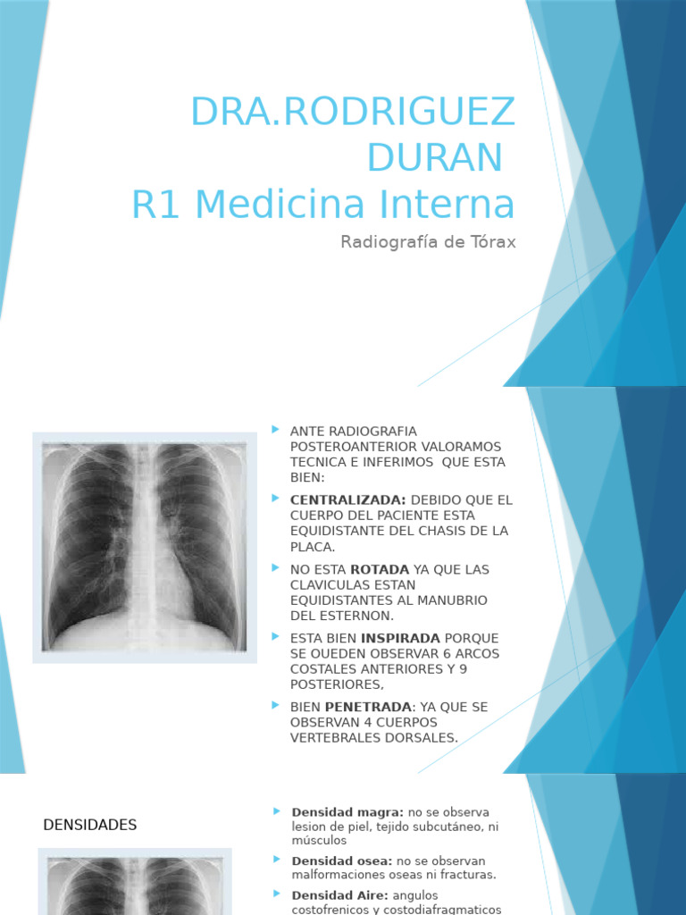Radiografia de Torax Normal | PDF