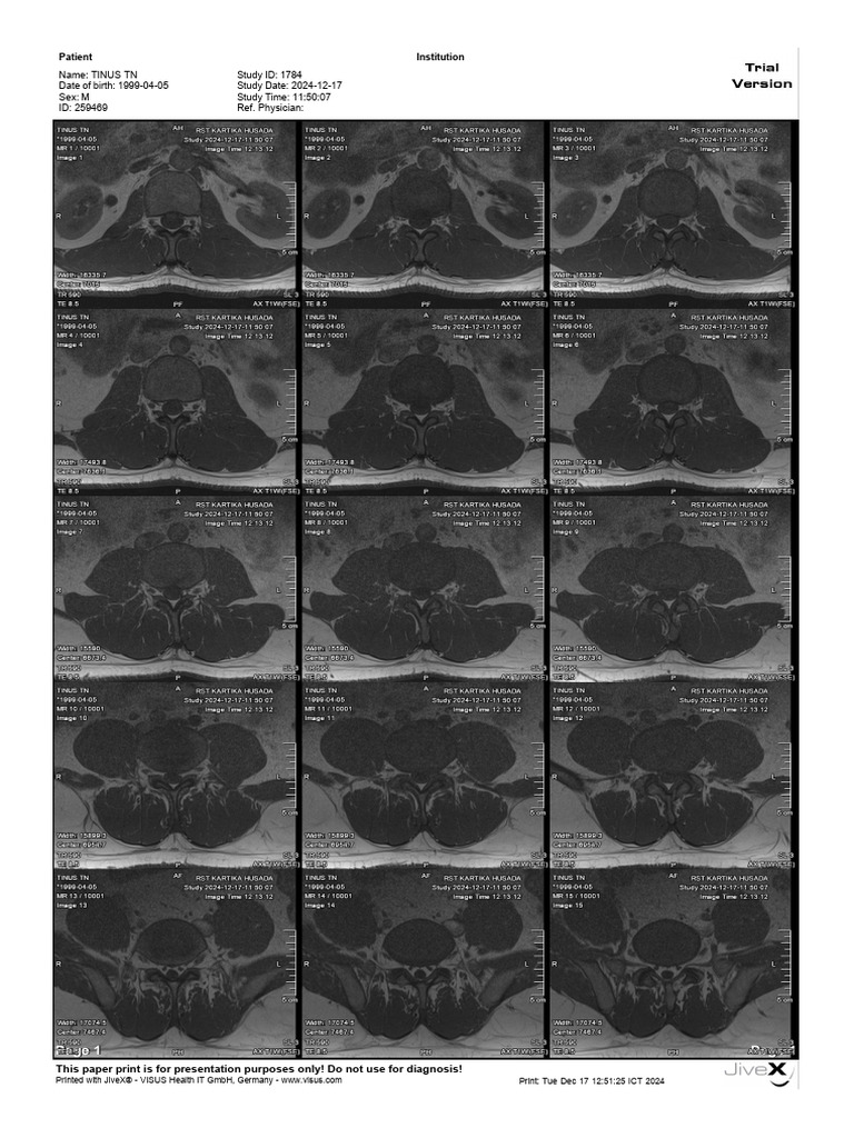 Axial T1, TN Tinus | PDF