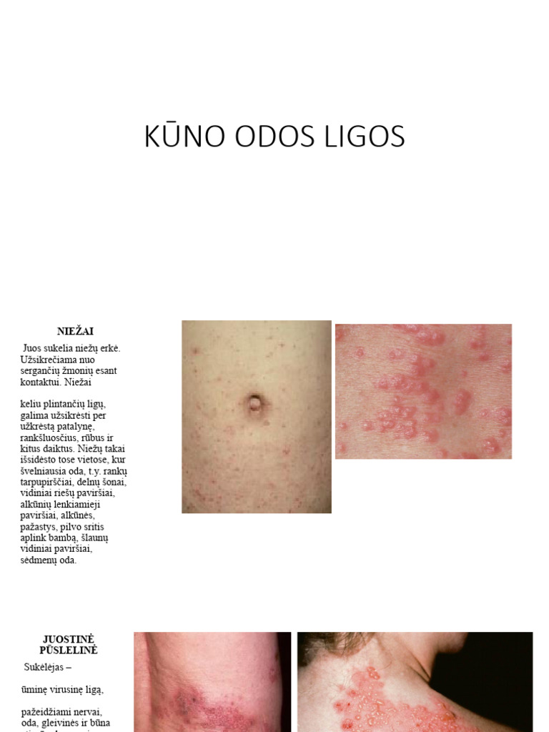 Kūno Odos Ligos | PDF