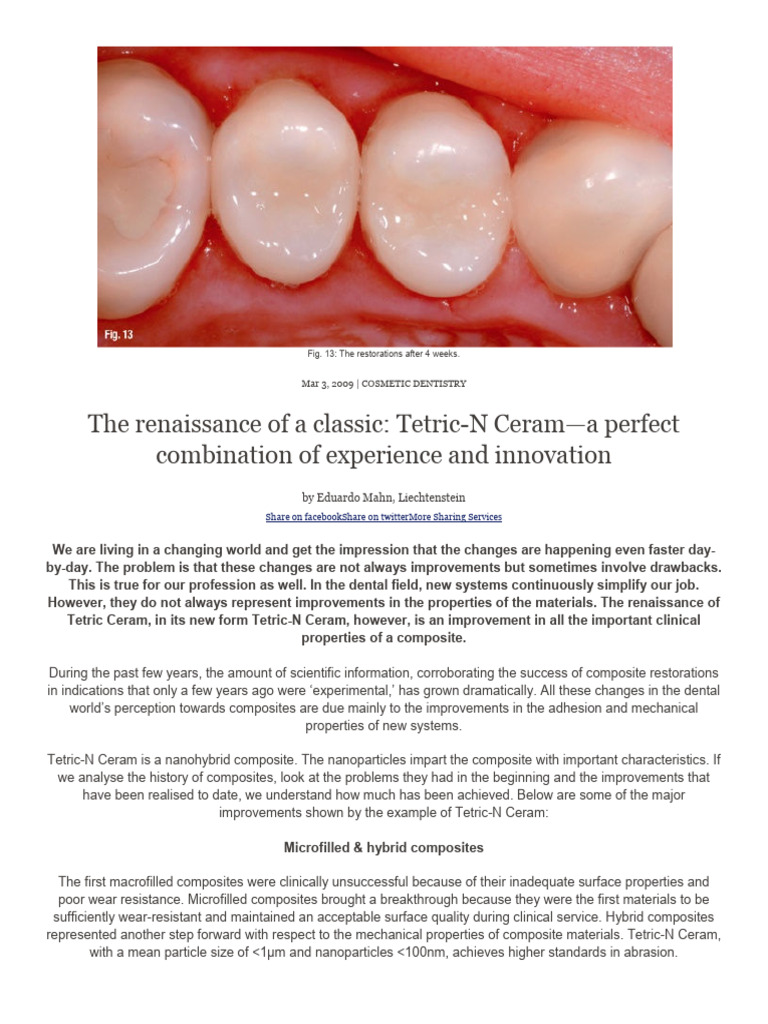 Tetric N Ceram The Renaissance of A Classic | PDF | Composite Material ...