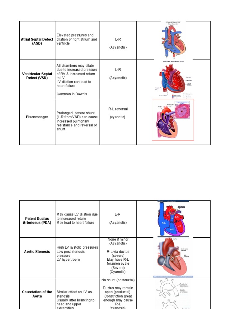 Congenital Heart Defects