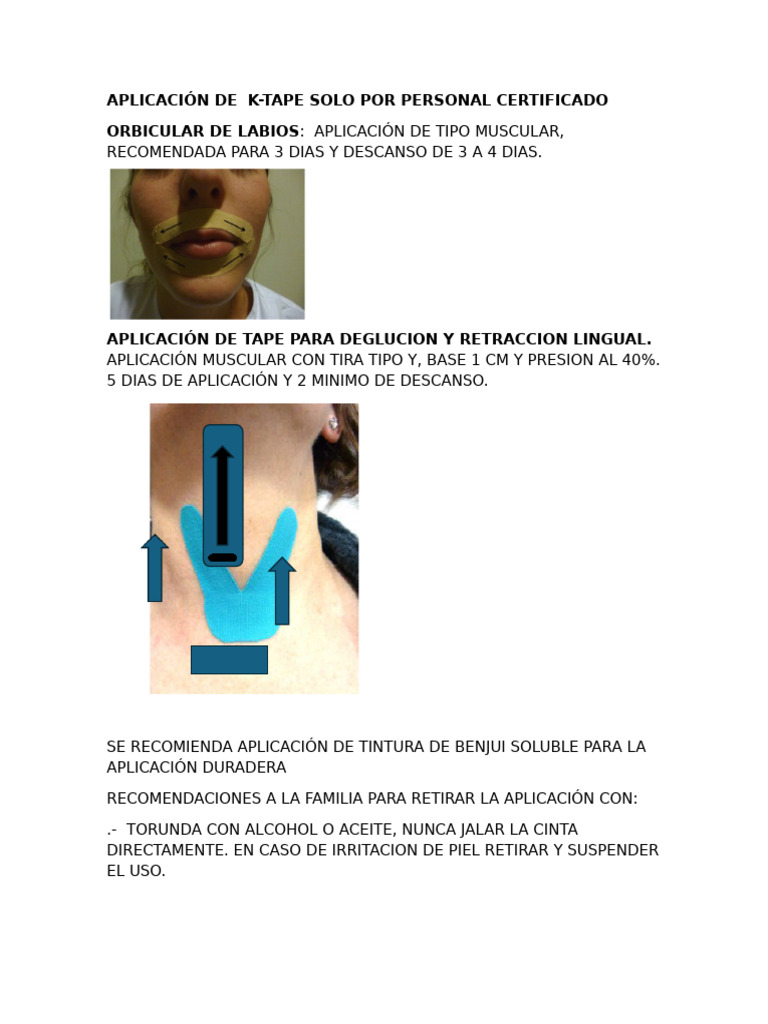 AplicaciÓn De K Tape Pdf