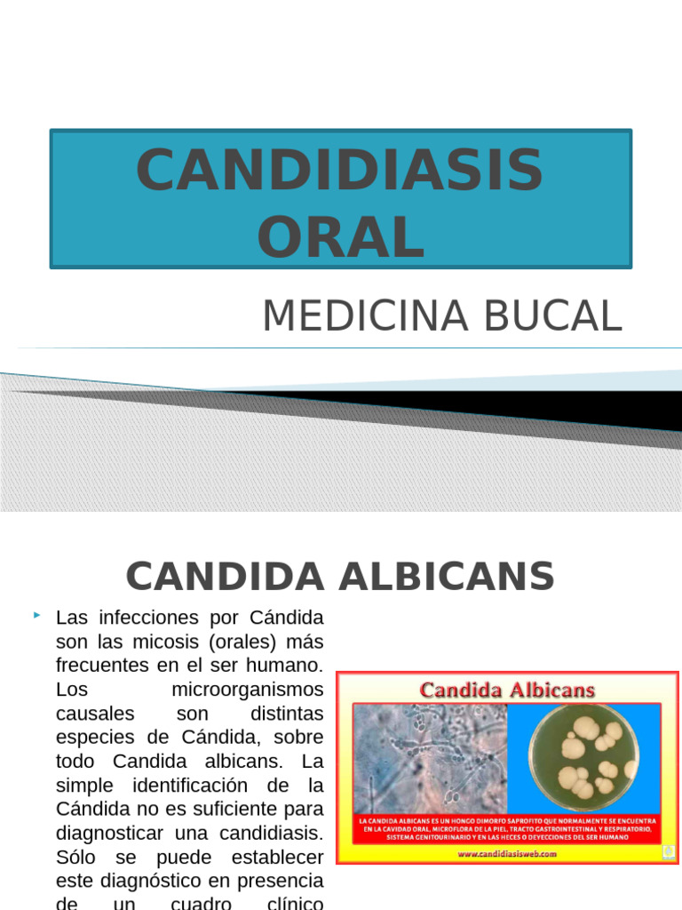 Candidiasis Oral | PDF