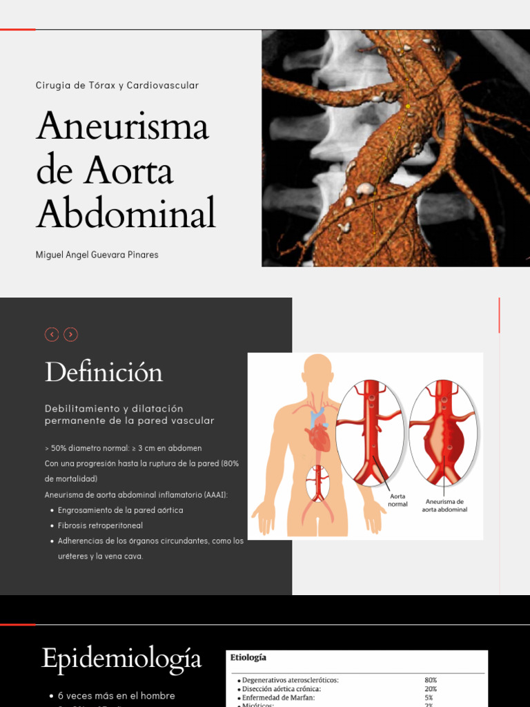 Aneurisma de Aorta Abdominal | PDF | Abdomen | Aorta
