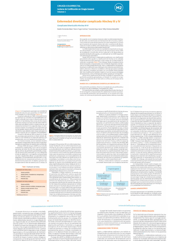 Enfermedad Diverticular Complicada Hinchey III y IV | PDF