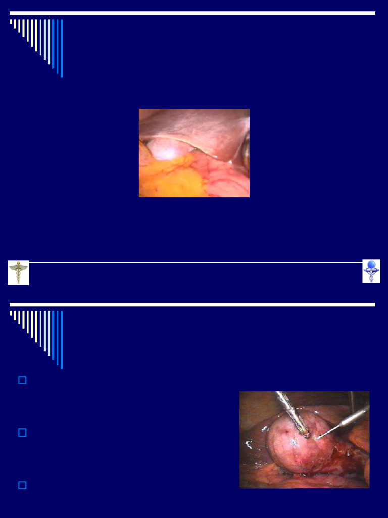 Laparoscopic Cholecystectomy | PDF | Gallbladder | Surgery