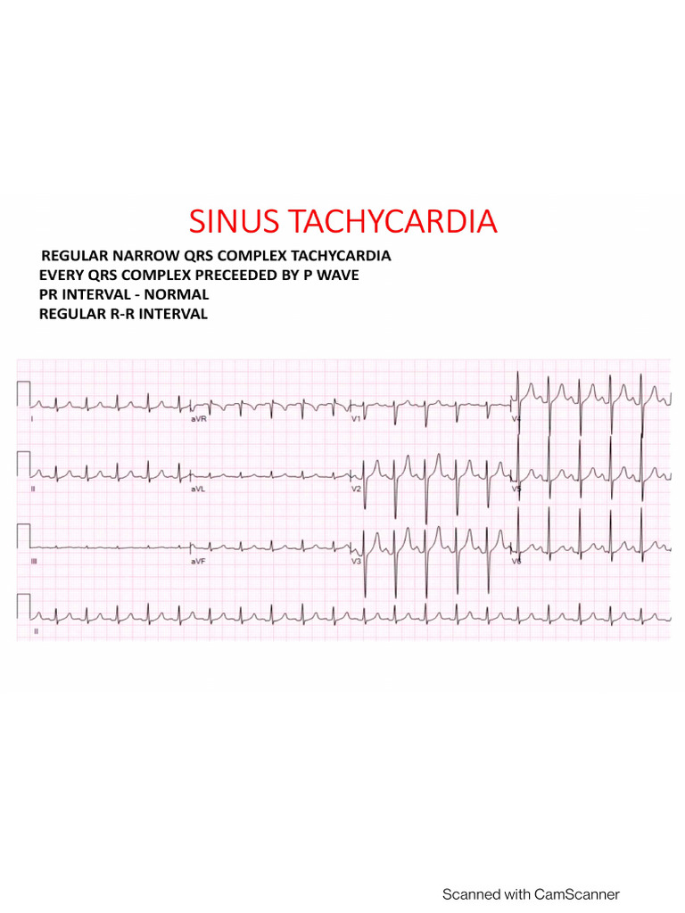 Ecg Compiled | PDF
