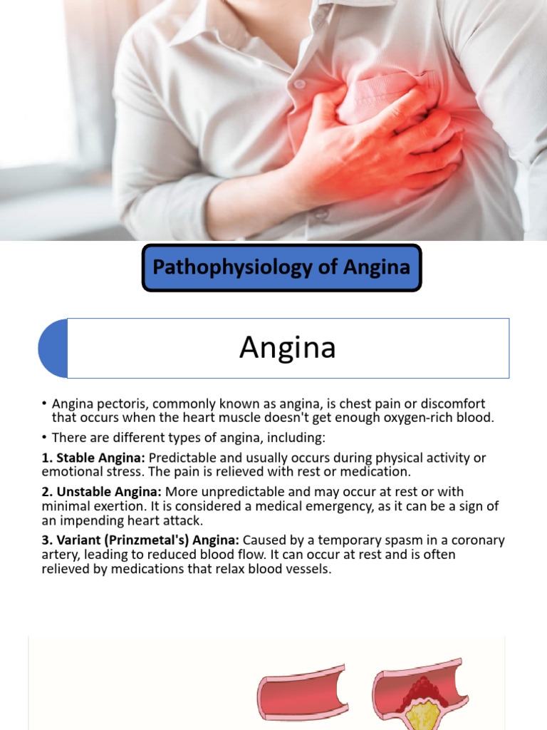 Pathophysiology of Angina | PDF | Coronary Artery Disease | Cardiac Muscle