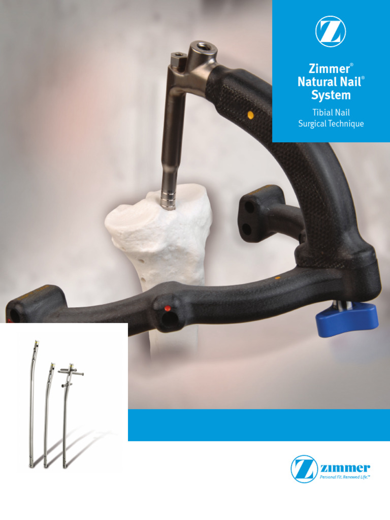 Zimmer Natural Nail System Tibial Nail Surgical Technique | PDF | Screw ...