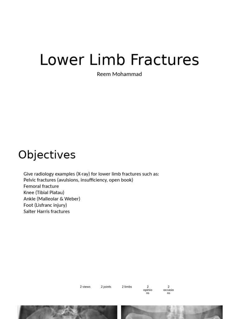 Radiology Guide to Lower Limb Fractures | PDF | Pelvis | Ankle