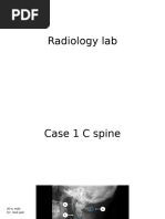 Bone Age Specific X-Rays | PDF
