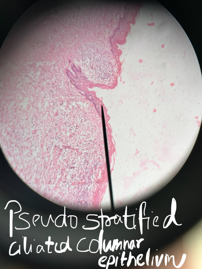 Maxillary Sinus | PDF