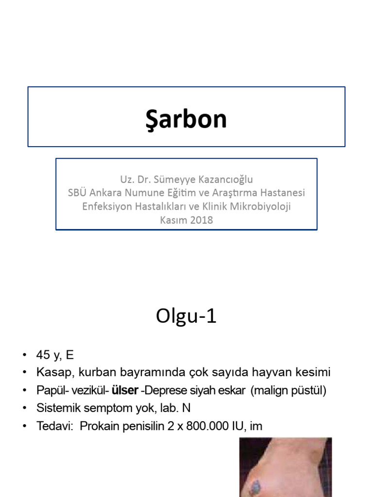 Sarbon | PDF