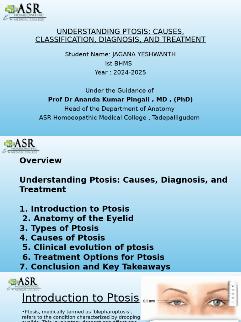 Understanding Ptosis Causes Classification Diagnosis and Treatment ...