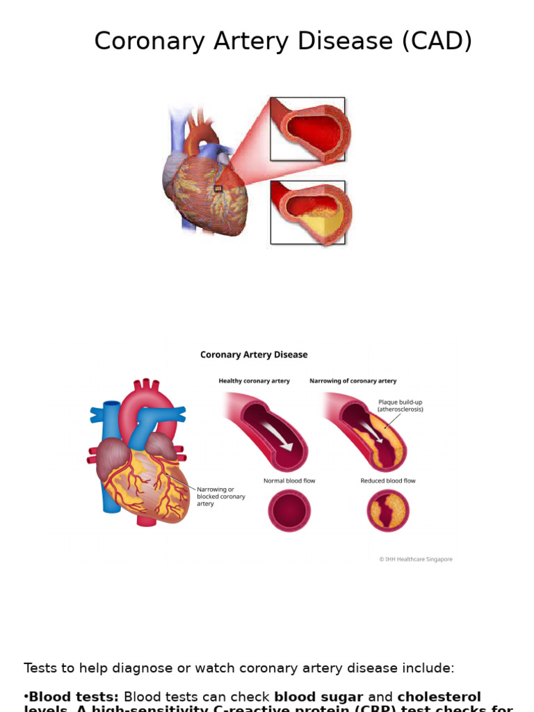 Coronary Artery Disease (CAD) | PDF | Heart | Coronary Circulation