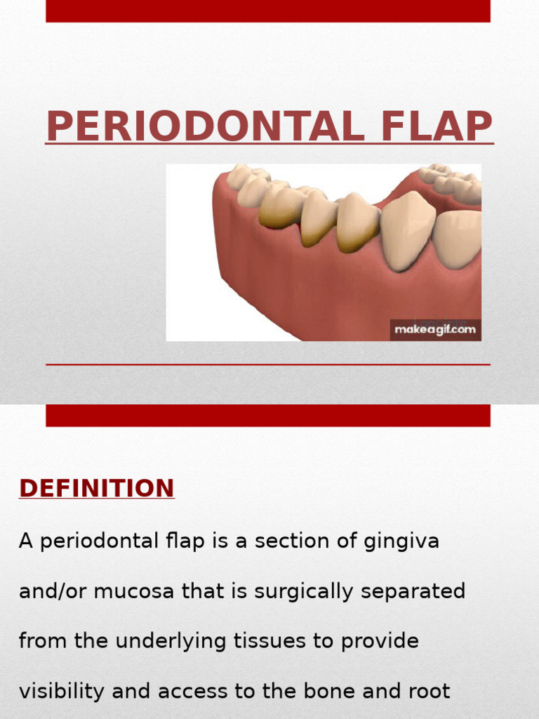 Principles of Periodontal Flap Design | PDF | Periodontology | Surgical ...