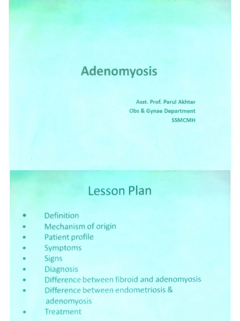 Adenomyosis | PDF