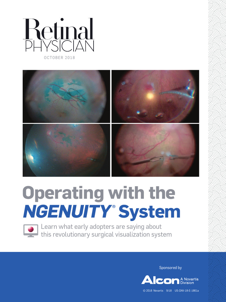 1018 Alcon Ngenuity Digital Edition Rev10 4 1 | PDF | Surgery | 3 D Film