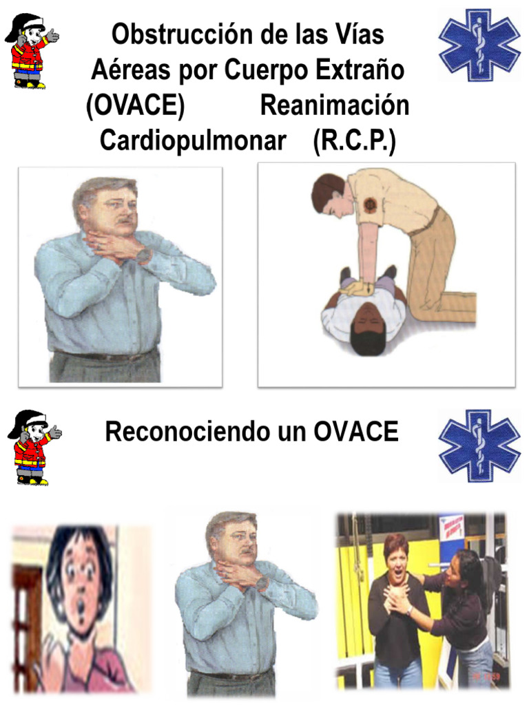 Guía de Emergencia para OVACE y RCP | PDF