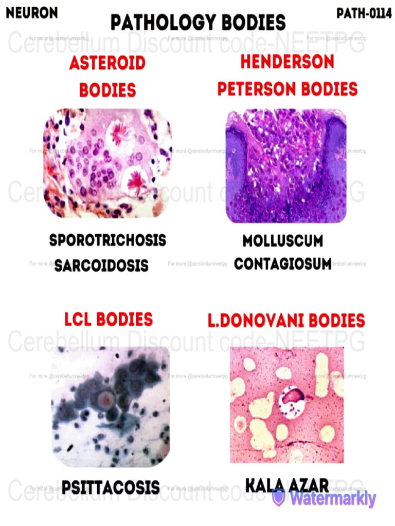 Pathology Bodies by Cerebellumneetpg | PDF | Diseases And Disorders ...