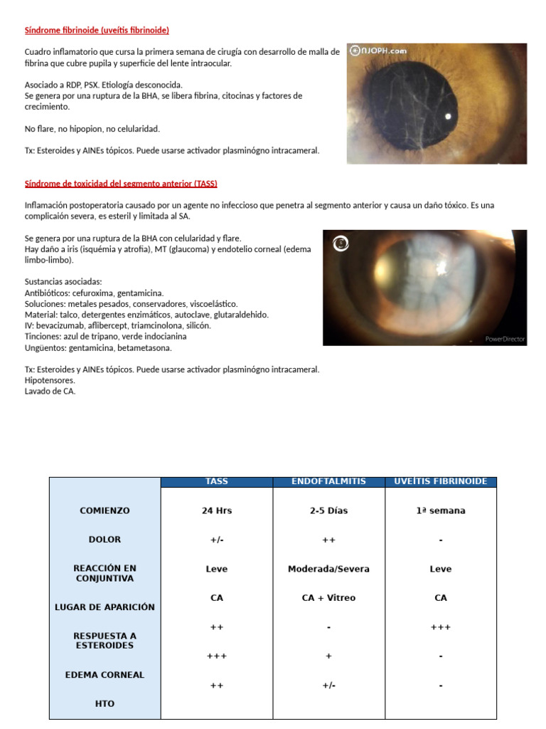 Complicaciones PO Faco | PDF