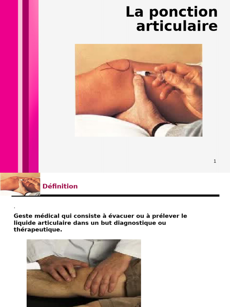 Ponction articulaire : technique et risques | PDF | Hémostasie ...