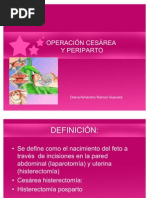 Pasos Quirúrgicos para La Cesárea Tipo Kerr | PDF | Abdomen | Seccion ...